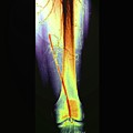Blocked Femoral Artery Greeting Card by Zephyr/science Photo Library